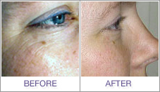 Light up! LED RED, BLUE, AMBER LIGHT