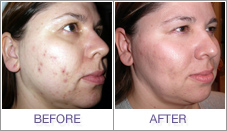 Light up! LED RED, BLUE, AMBER LIGHT